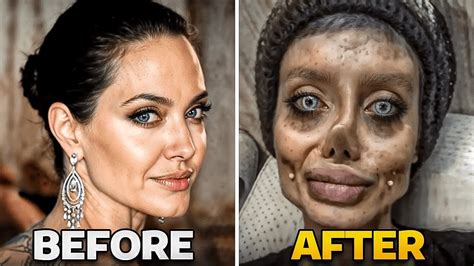 famous celebrities unrecognizable after plastic surgery gone wrong