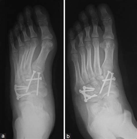 Rxharun A Global War Against Illness