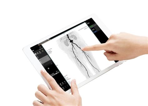 How Long Does An Angiogram Take Ae