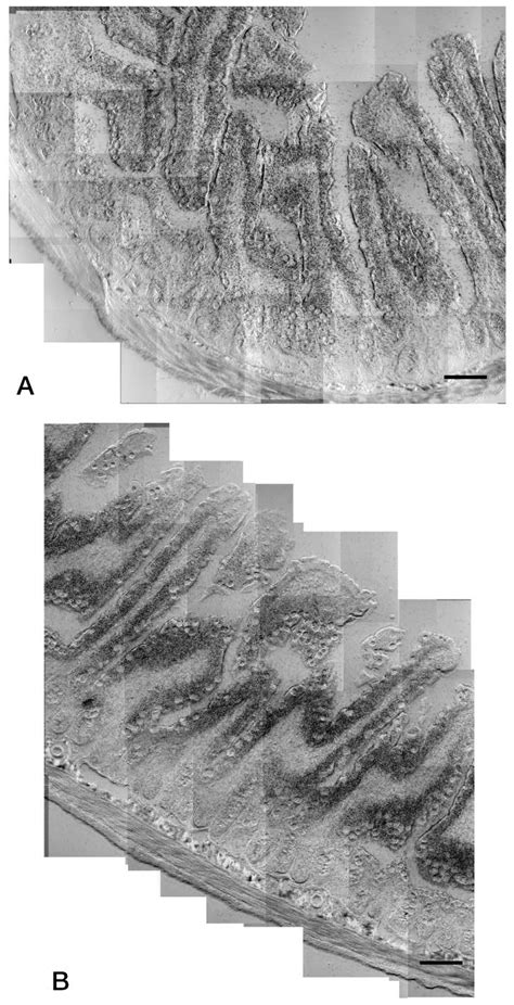 Localization Of I Fabp And L Fabp Transcripts In Rat Ileal Sections By Download Scientific
