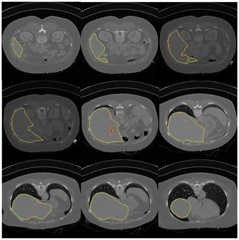 segmentation results on each slice download scientific diagram