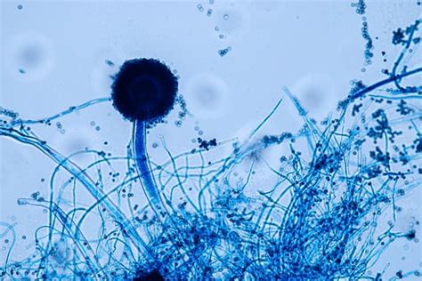 Aspergillus Microscopic