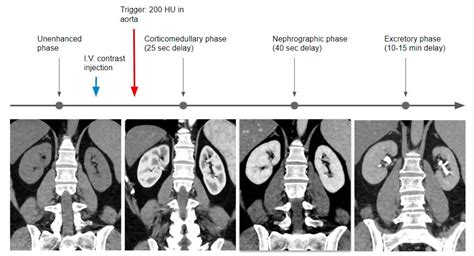 Computed Tomography Urography State Of The Art And Beyond