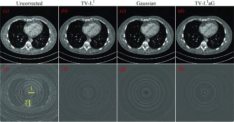 comparison of reconstructed images from different filtering a d