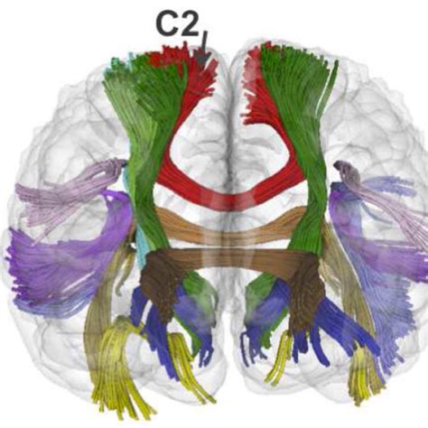 3d Visualization Of 10 Fiber Pathways Including 21 Tracts Bilaterally