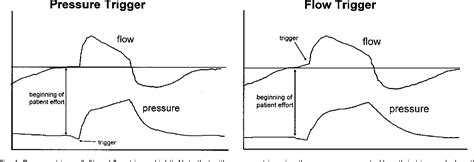 Mechanical Ventilator Waveforms