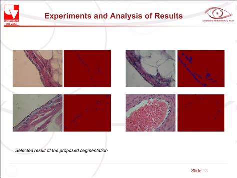 a cells segmentation approach in epithelial tissue using histology