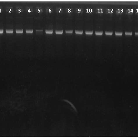Gel Image Of Amplified Ompc Gene In Salmonella Isolates Lanes 117
