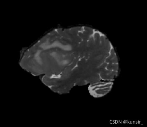 Python显示磁共振图像（mri）（pydicom）python基于mri坐标数据生成图片 Csdn博客