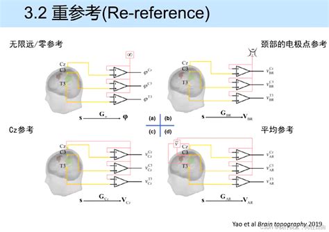 脑电信号处理与特征提取——4脑电信号的预处理及数据分析要点（彭微微） Csdn博客