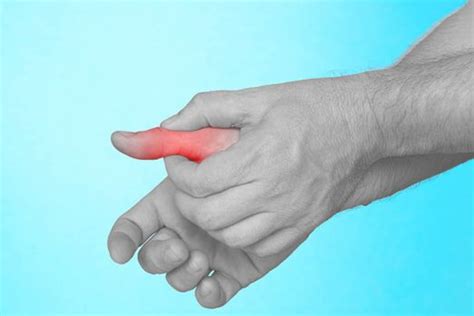 Vondt I Tommelen Tommelsmerter Diagnose Symptomer Behandling