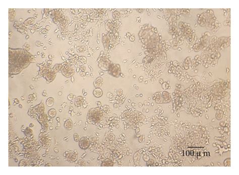 CPE Of LMH Cells Infected With The N DRV LY A H Infected Download Scientific Diagram