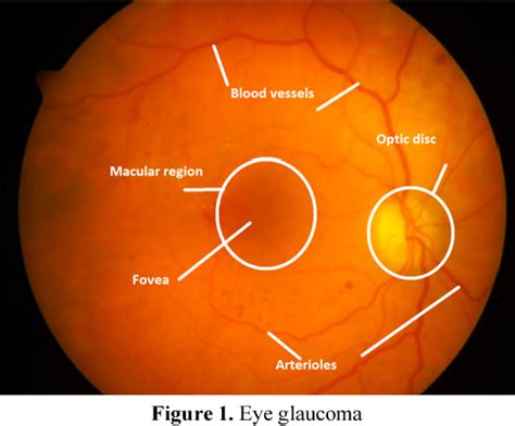 figure 1 from fundus image classification using convolutional neural