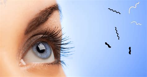 What Are Eye Floaters Pictures Of Eye Floaters