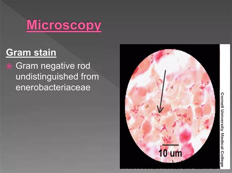 Pseudomonas 161203195049 Pdf