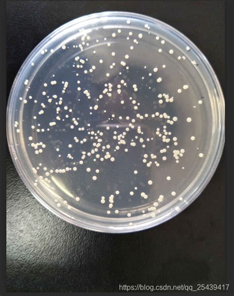 图像处理与菌落计数 csdn博客
