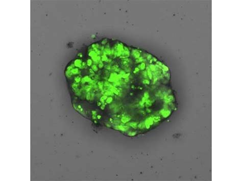 Automated Organoid Imaging And High Throughput 3d Analysis Olympus Ls