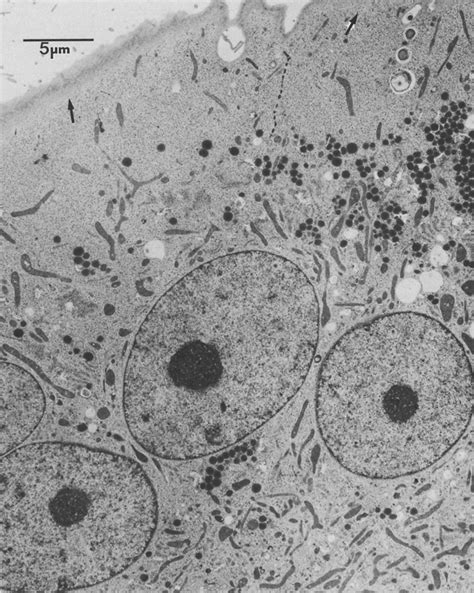 Typical Ultrastructural Morphology Of A Cultured Multinucleated Cell