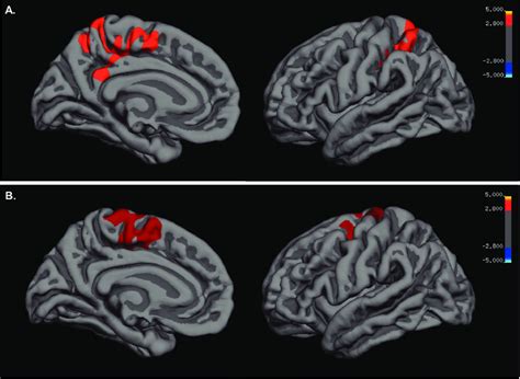 Brain Maps For Vertex Wise Analyses A Brain Map Of The Left