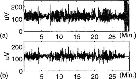 figure i from noise detection and denoising on electrogastrography