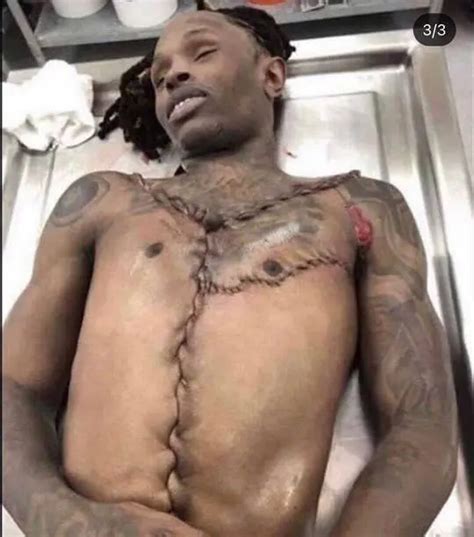 Rapper King Von After Autopsy Scrolller