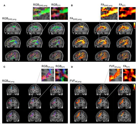 Figure Metrics Maps Using Angular Weight Recover The Properties Along Download Scientific