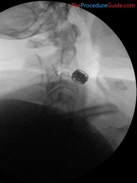 Stories Archive The Procedure Guide