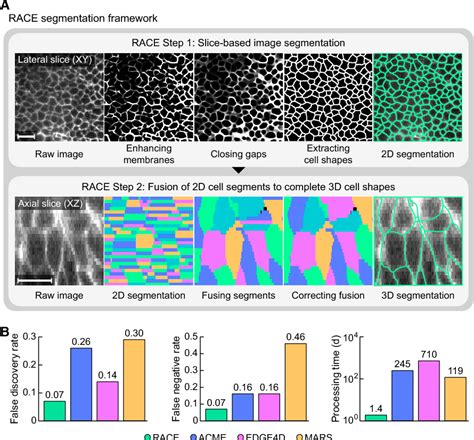 Figure 1 From Real Time Three Dimensional Cell Segmentation In Large Scale Microscopy Data Of