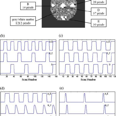 Schematic Illustration Showing Spatial And Temporal Patterns In