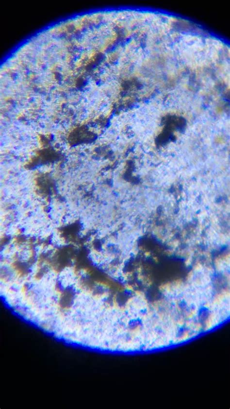 are the tiny swimming blobs bacteria 250x pond water r microscopy