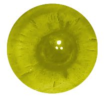 Cataract Tables Epping Eye Surgery NSW