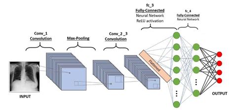 nih chest x ray classifier