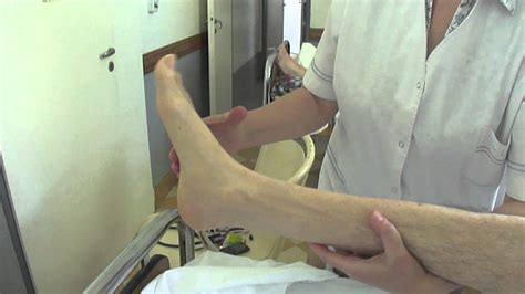 Clonus After A Stroke Nejm Youtube