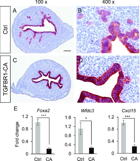 constitutive activation of tgfbr1 in mouse uterus causes adenogenic