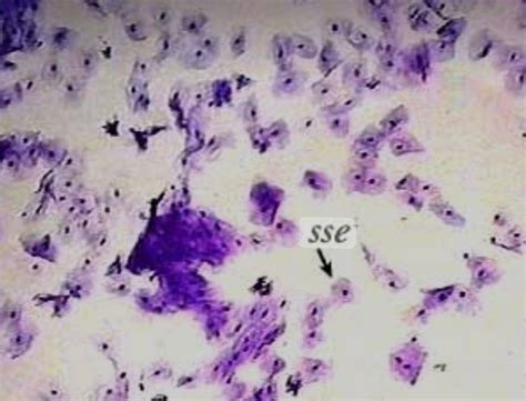 [solved] Picture Of A Simple Squamous Epithelium Slide At The 10x Objective Course Hero