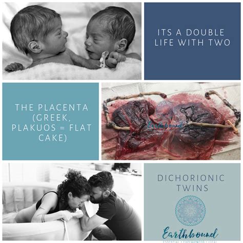 Dichorionic Twins Fraternal