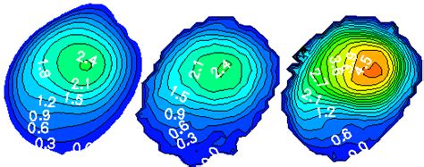 Comparison Of Cfd Left And Mri Centre Axial Velocity Contour Plots