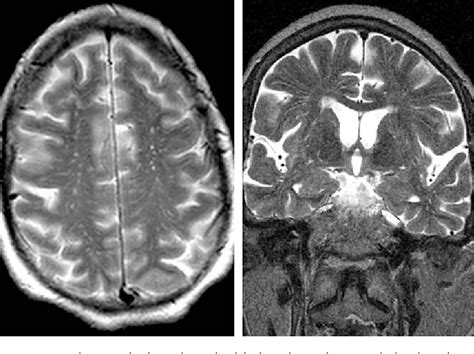 Figure 1 From Neurology Postgraduate Training What Is To Be Done