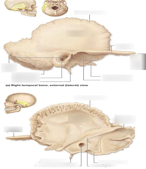 Temporal Bone Anatomy Diagram Diagram Quizlet
