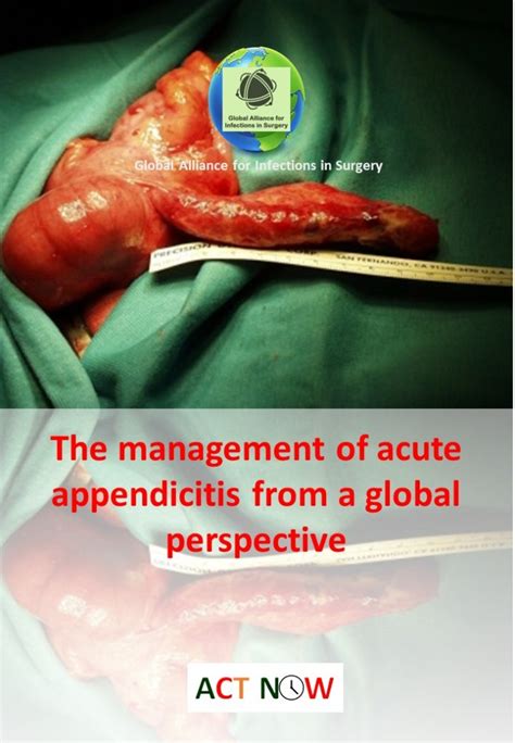 The Management Of Acute Appendicitis From A Global Perspective Global Alliance For Infections