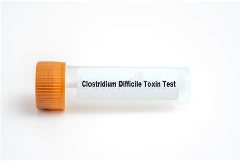 Clostridium Difficile Toxin Test Clostridium Difficile Toxin Test Stock