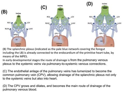 Classification And Pathophysiology Of Tapvc Pptx