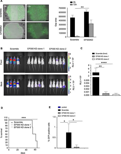 Ep300 Kd Reduces Cell Metastatic Colonization And Circulating Tumor Download Scientific Diagram