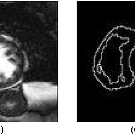 Myocardial Border Detection A En Border Detection Result B Ep