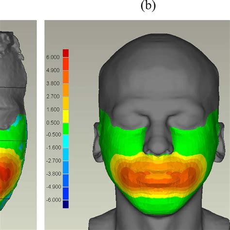 Pdf Development And Validation Of A Three Dimensional Finite Element