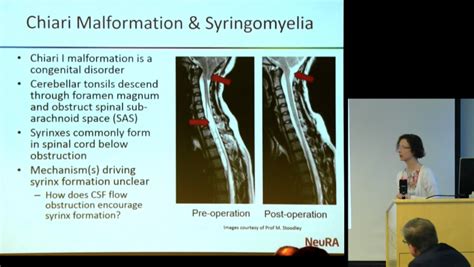 Computational Modeling Of Spinal Perivascular Flow Bobby Jones Csf