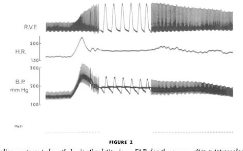Modified Nodal Analysis Semantic Scholar Modified Nodal Analysis Semantic Scholar