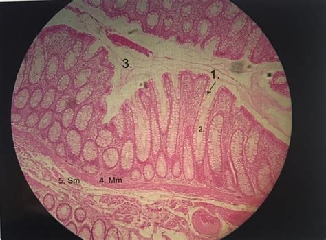 Large Intestine And Esophagus Microscope Flashcards Quizlet