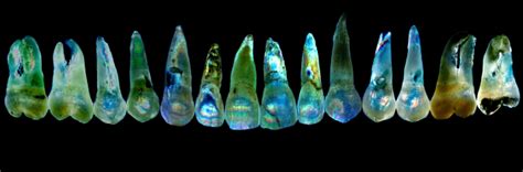 Online Residency Program In Esthetic Dentistry Artistic Principles