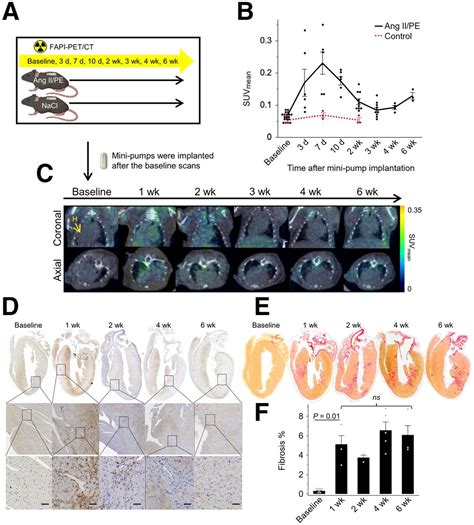 How Rapidly Does The Fapi Pet Signal Reverse Following Therapy